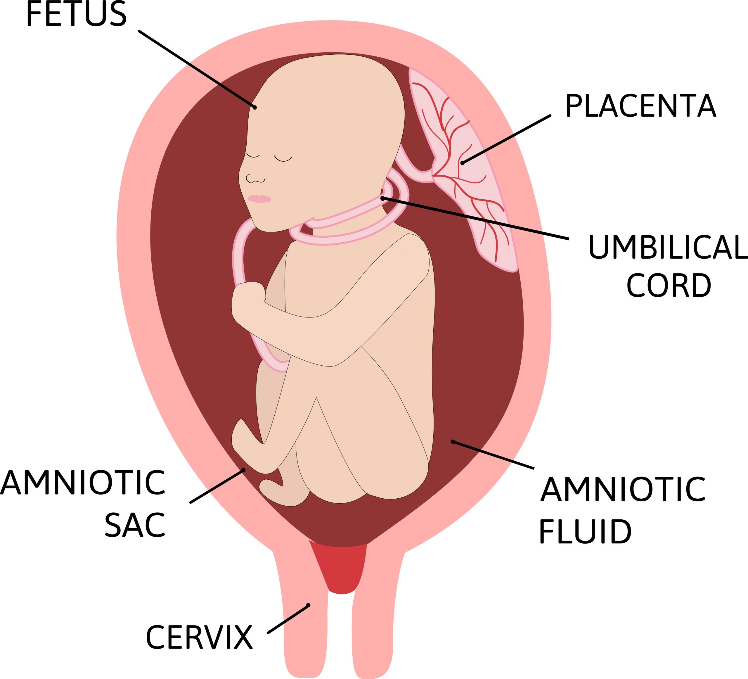 Umbilical Cord Around Neck During Pregnancy Always Means Brain Injury Umbilical Cord Around Neck During Pregnancy Always Means Brain Injury